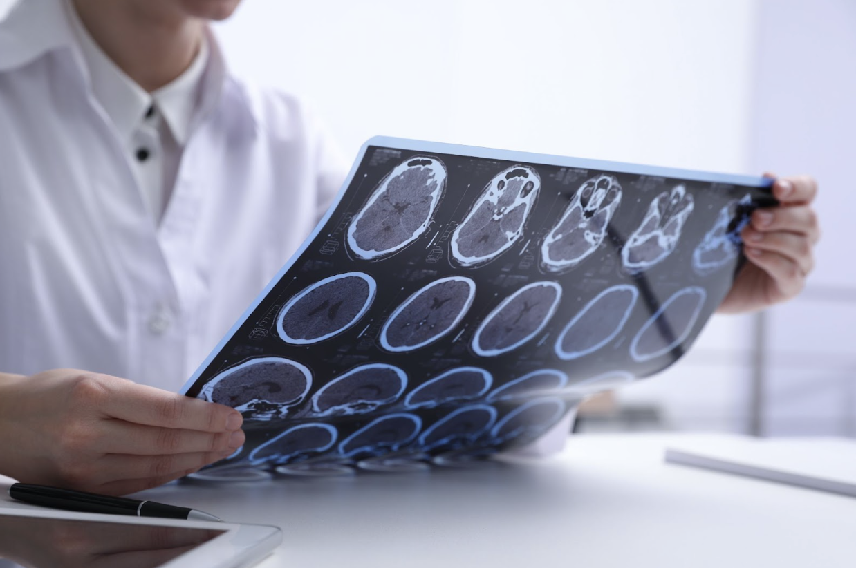 7 Facts to Know About Multiple Sclerosis & Disability